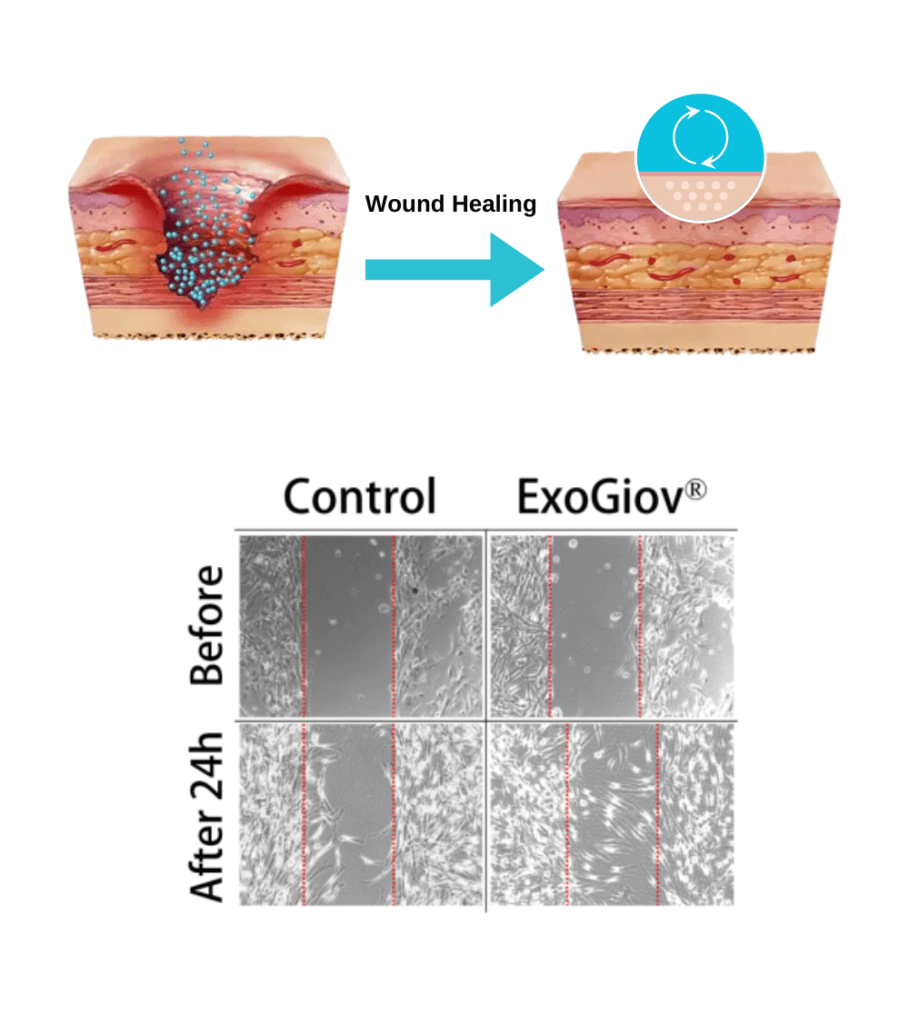 ExoGiov Cosmetics－AM BioTech Co., Ltd.