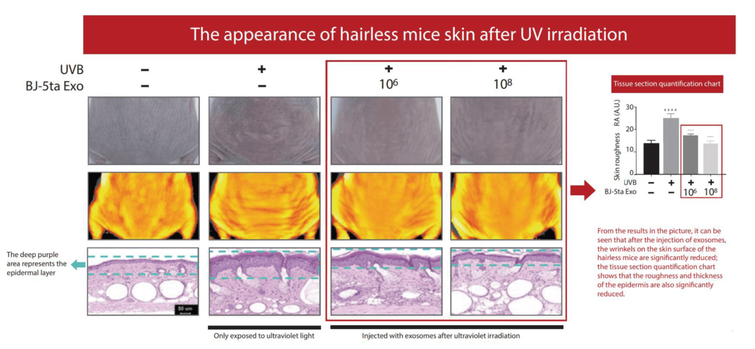 Exosomes Aid in Repairing Skin Aging Caused by UV Radiation - Exosome ...
